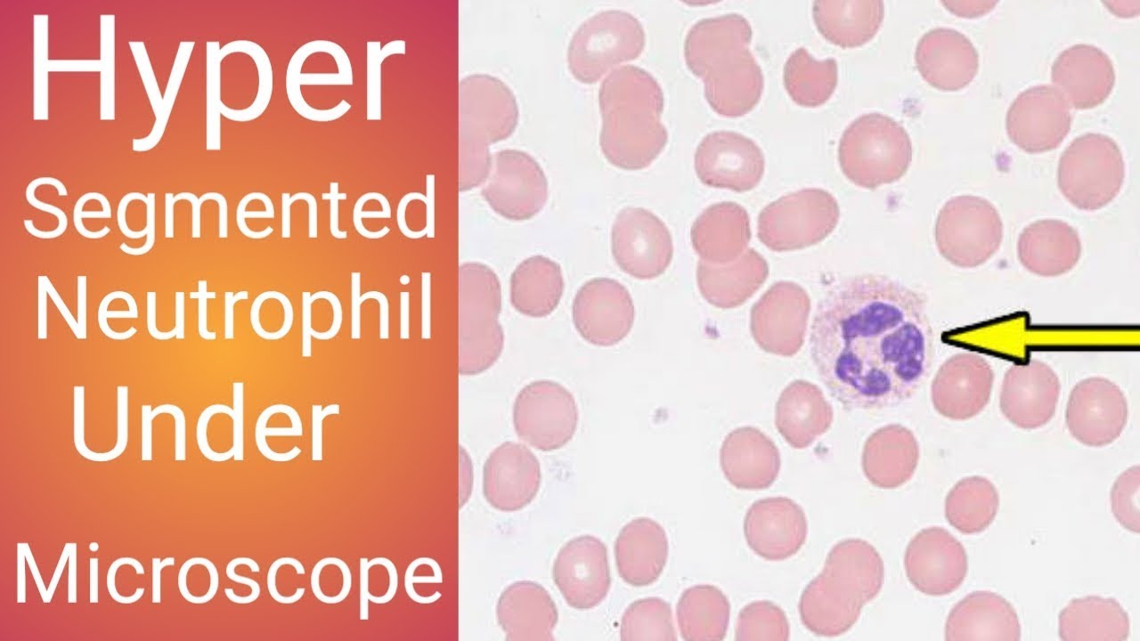 Segmented Neutrophil | Kind of wbc |How many kind of wbc - YouTube