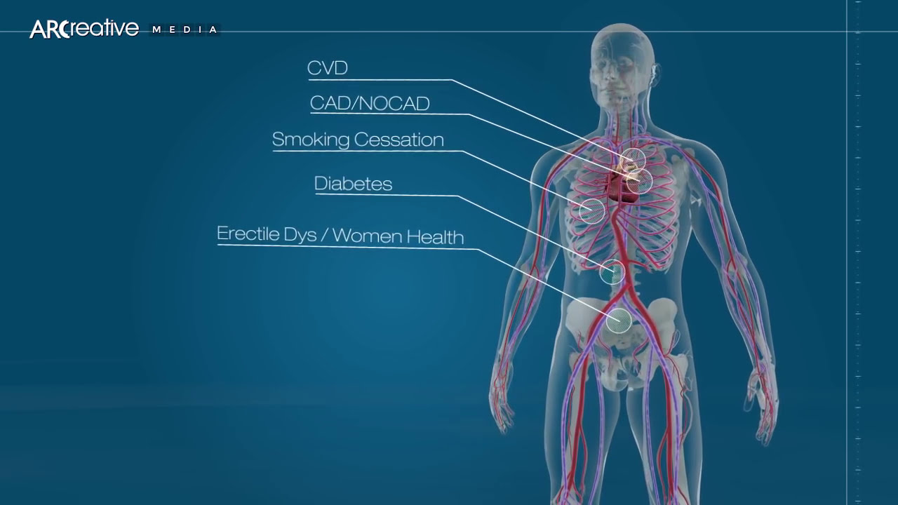 Vascular Health - EndoPat by Itamar Medical (3D Medical Device ...