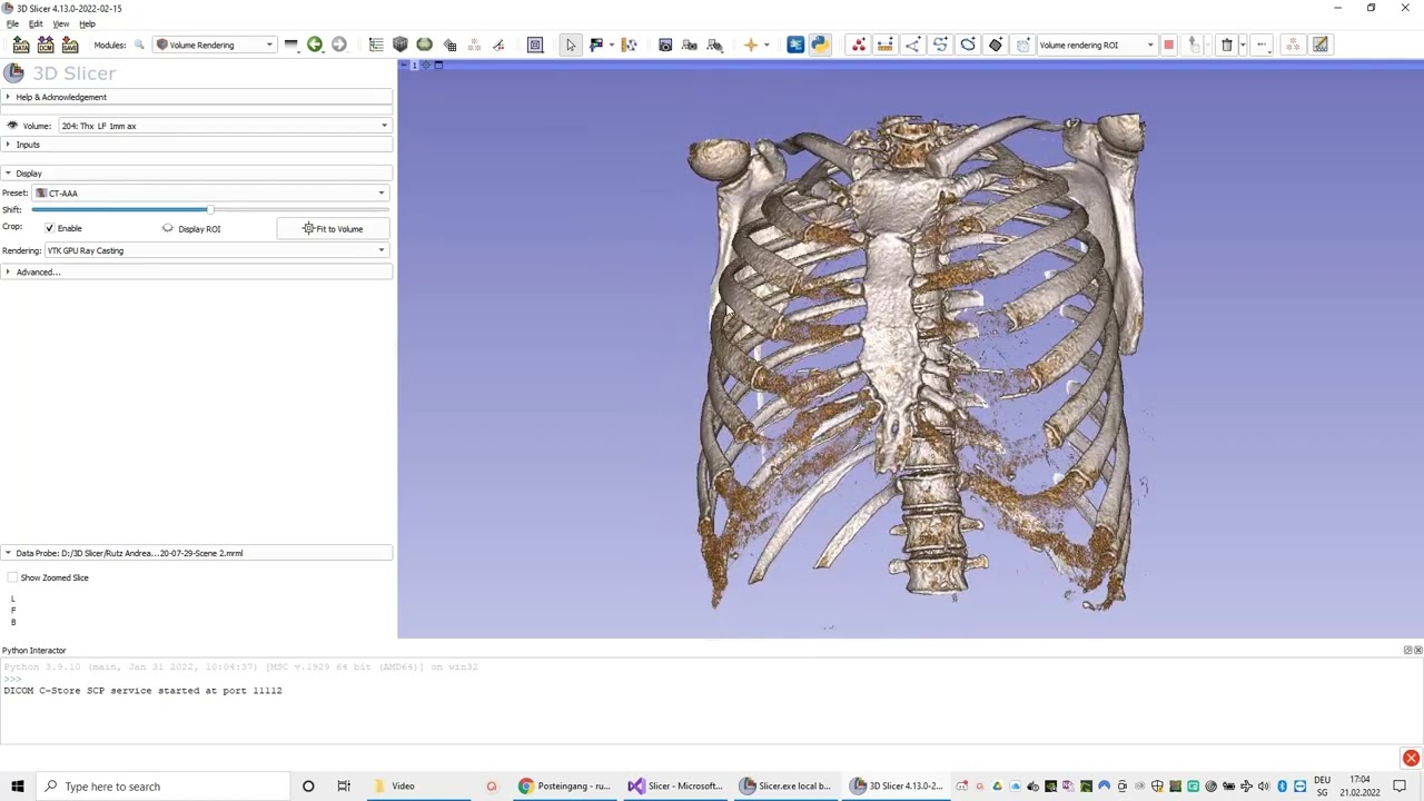 How to enable and disable the 3D cube and label in 3D Slicer - YouTube