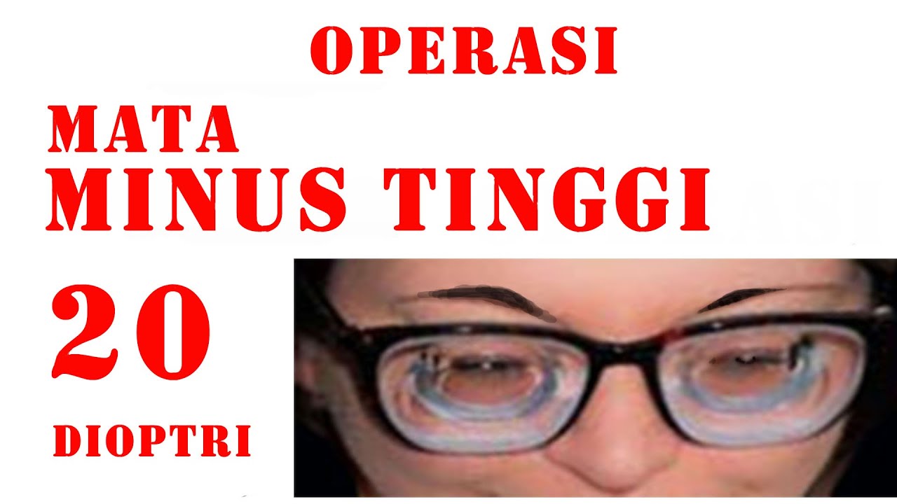 OPERASI MATA MINUS TINGGI - 20 DIOPTRI. |. SURGICAL TREATMENT OF HIGH ...