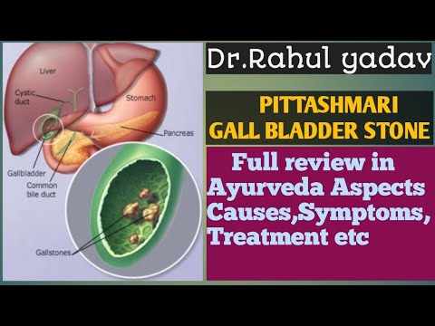 Pittashmari(Gall bladder stone) full review in Ayurvedic aspect - YouTube