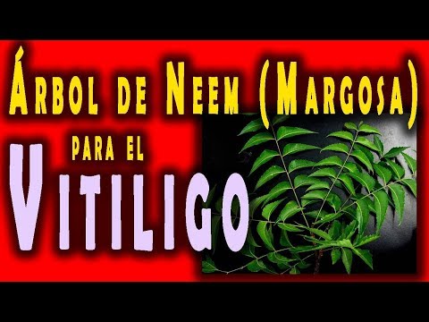Margosa O Neem Para El Vitiligo - YouTube