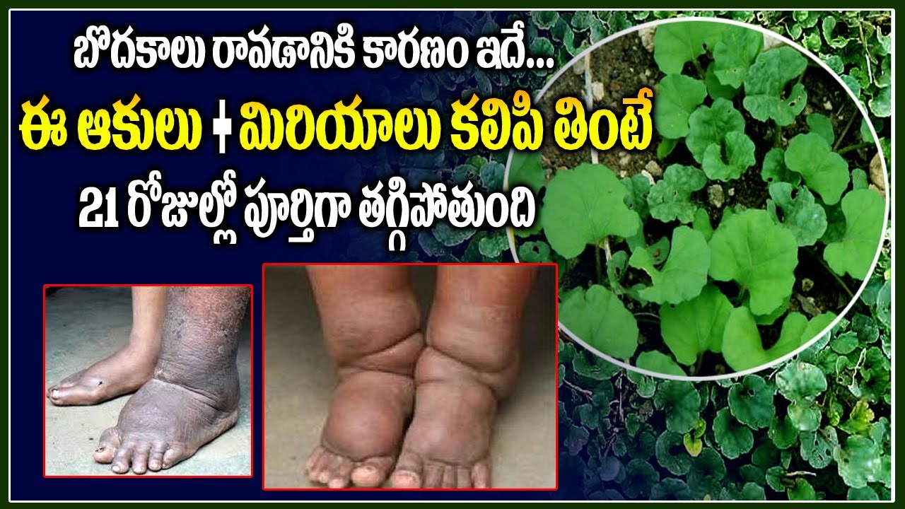 ఈ ఆకులూ మిరియాలు కలిపి తింటే 21 రోజులో బోదకాలు పూర్తిగా తగ్గిపోతుంది ...