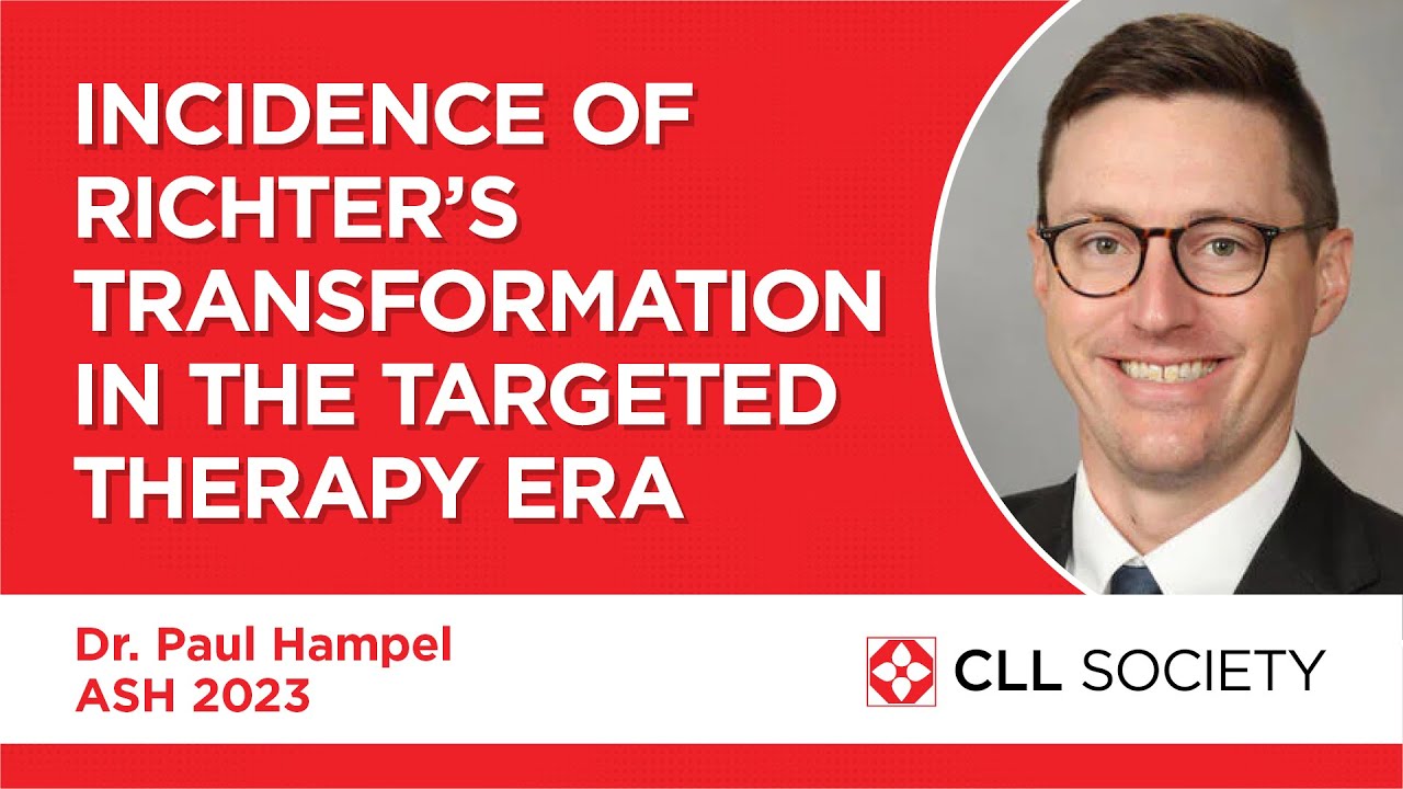 Incidence of Richter’s Transformation in the Targeted Therapy Era - Dr ...