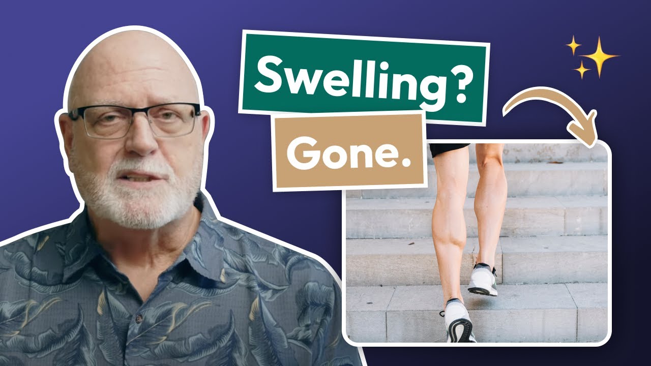 See How Kevin Solved Swollen and Achy Legs at Vein Envy | Patient ...