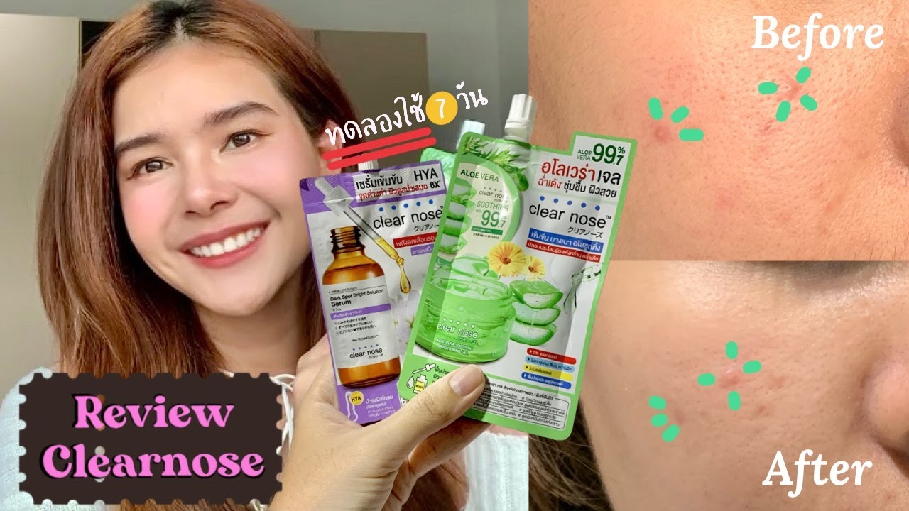 รีวิวว่านหางจระเข้ตัวใหม่จาก clearnose I ทดลองใช้คู่เซรั่มเคลียร์โนสซองม่วงตัวดัง 7 วันรู้เรื่อง ...