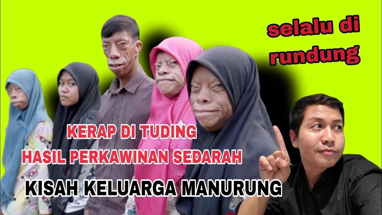 KELUARGA MANURUNG KERAP DI RUNDUNG || ALAMI KELAINAN LANGKA SYNDROM ...