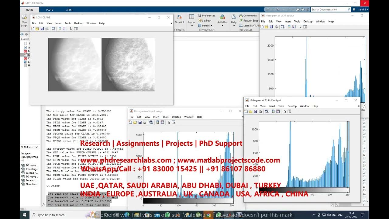 Contrast Limited Adaptive Histogram Equalization for mammography images MATLAB CLAHE code - YouTube