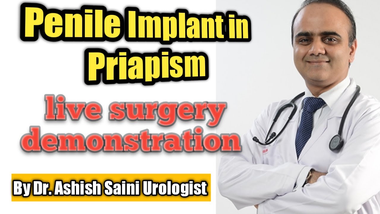 Penile Implant in Priapism - Live Surgery Demonstration by Dr Ashish ...