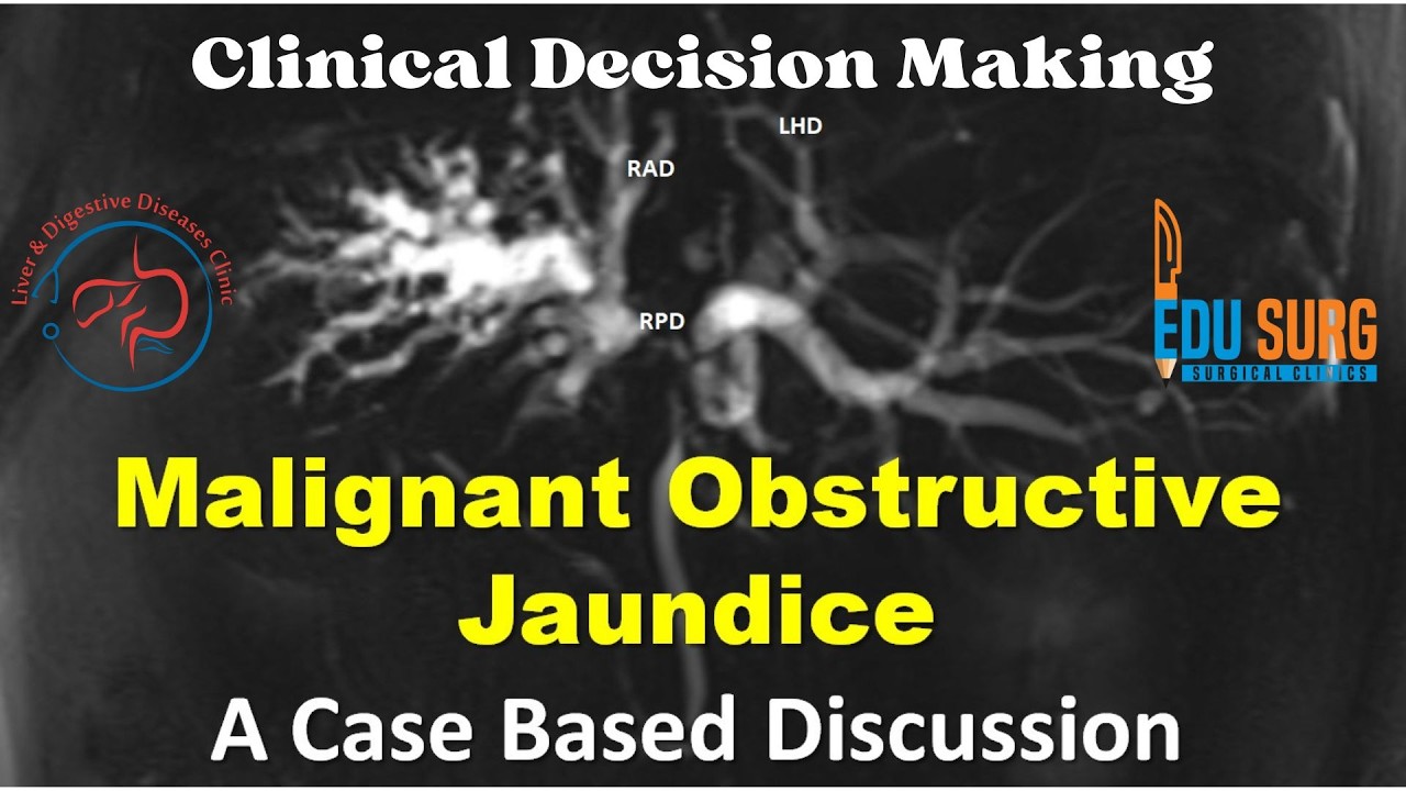 Case-based management of block at the liver hilum and hilar ...
