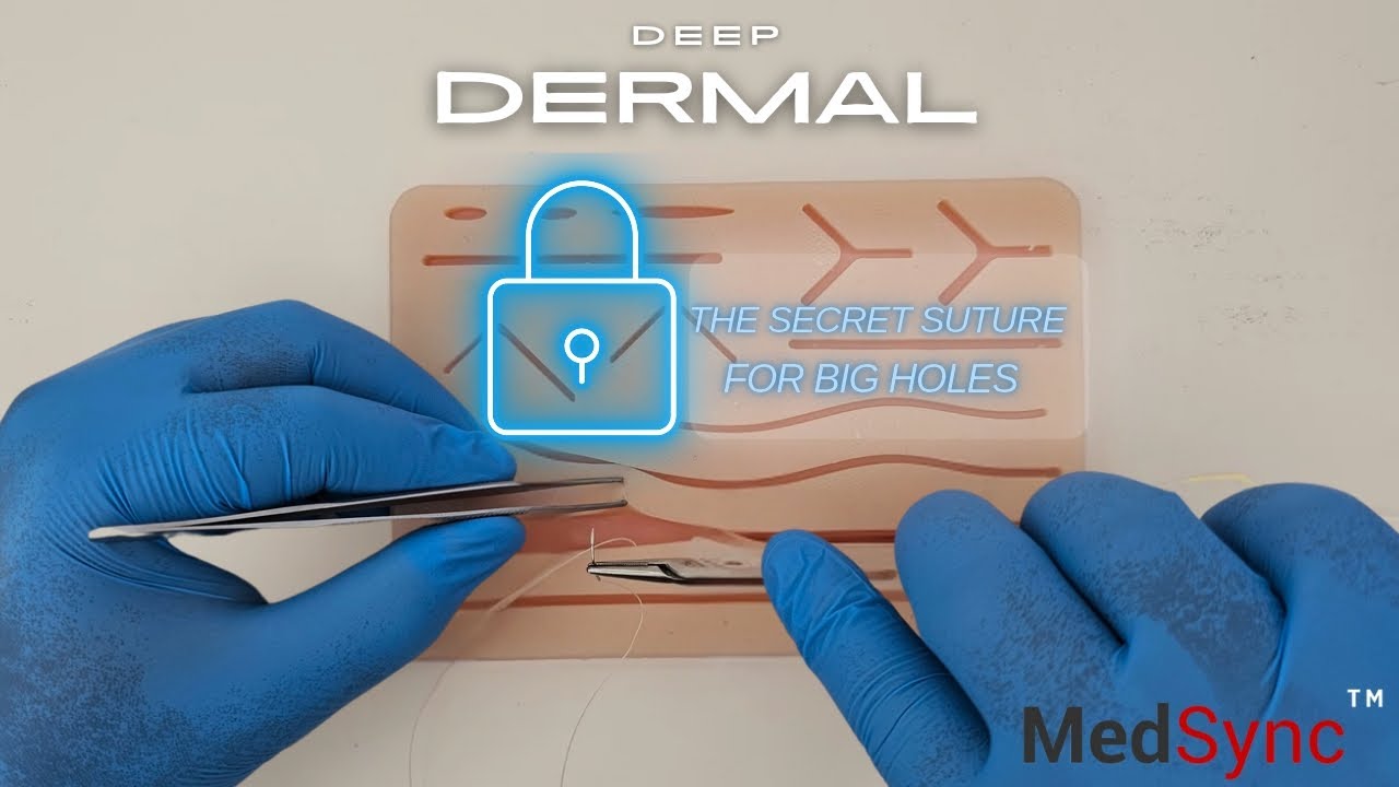Deep Dermal Sutures: How Plastic Surgeons Close The BIGGEST HOLES - YouTube