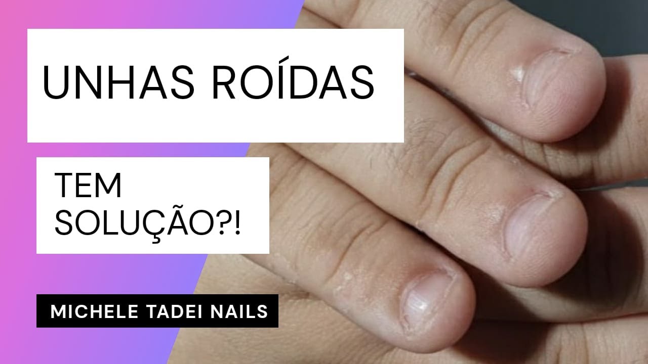 UNHA ROÍDA, DÁ PARA ALONGAR ?! - YouTube