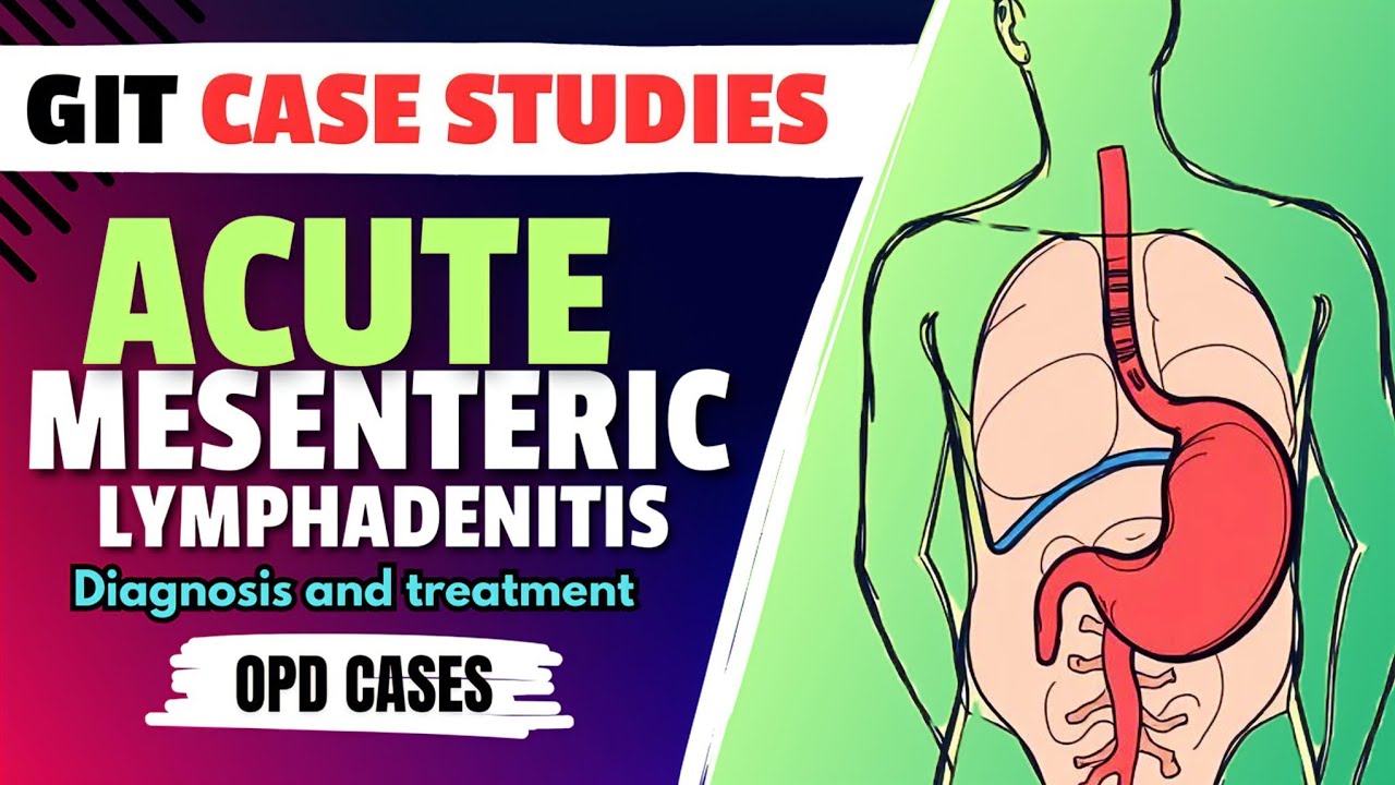 Acute mesenteric lymphadenitis clinical investigations, diagnosis and ...