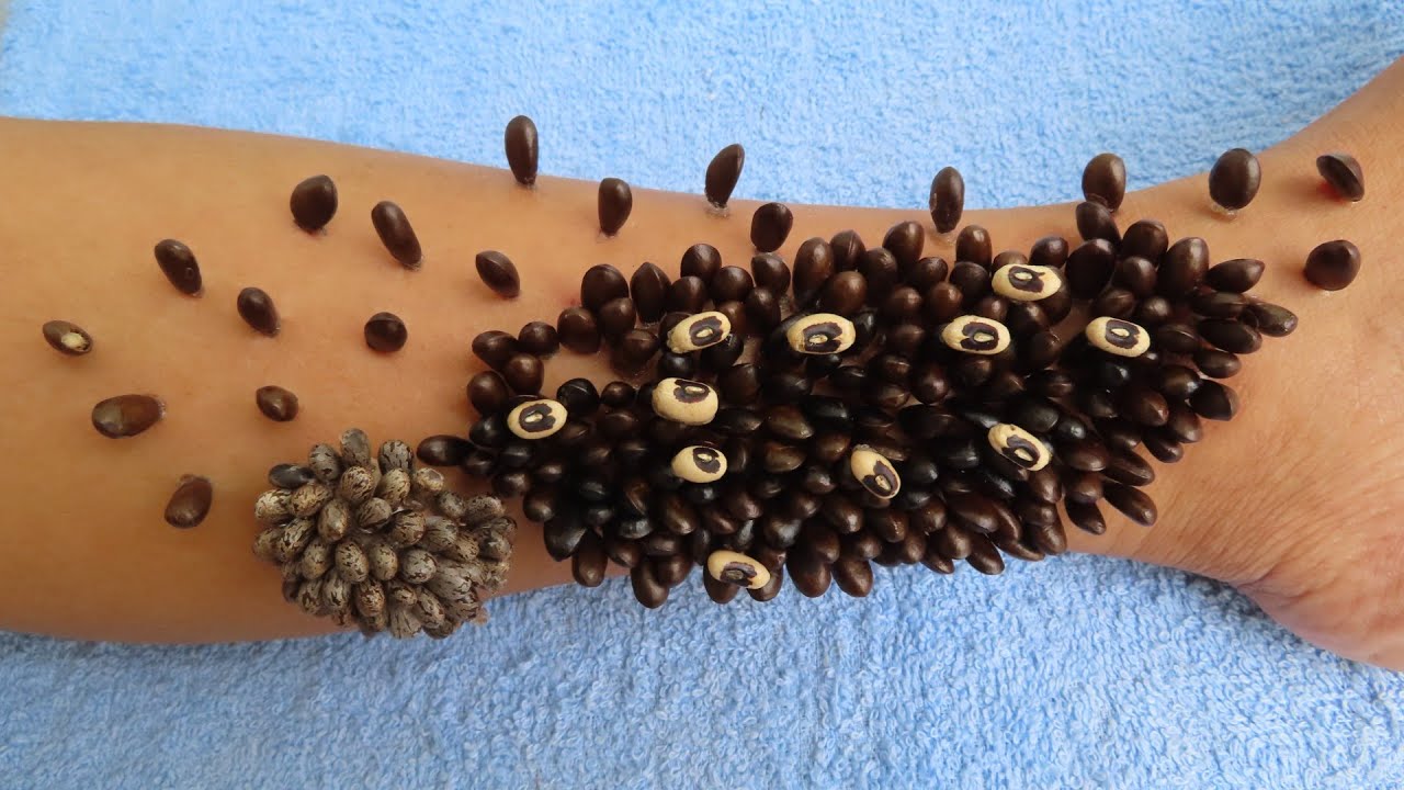 [ Lady Leg ] Amazing removing strange ticks style human on leg woman ...