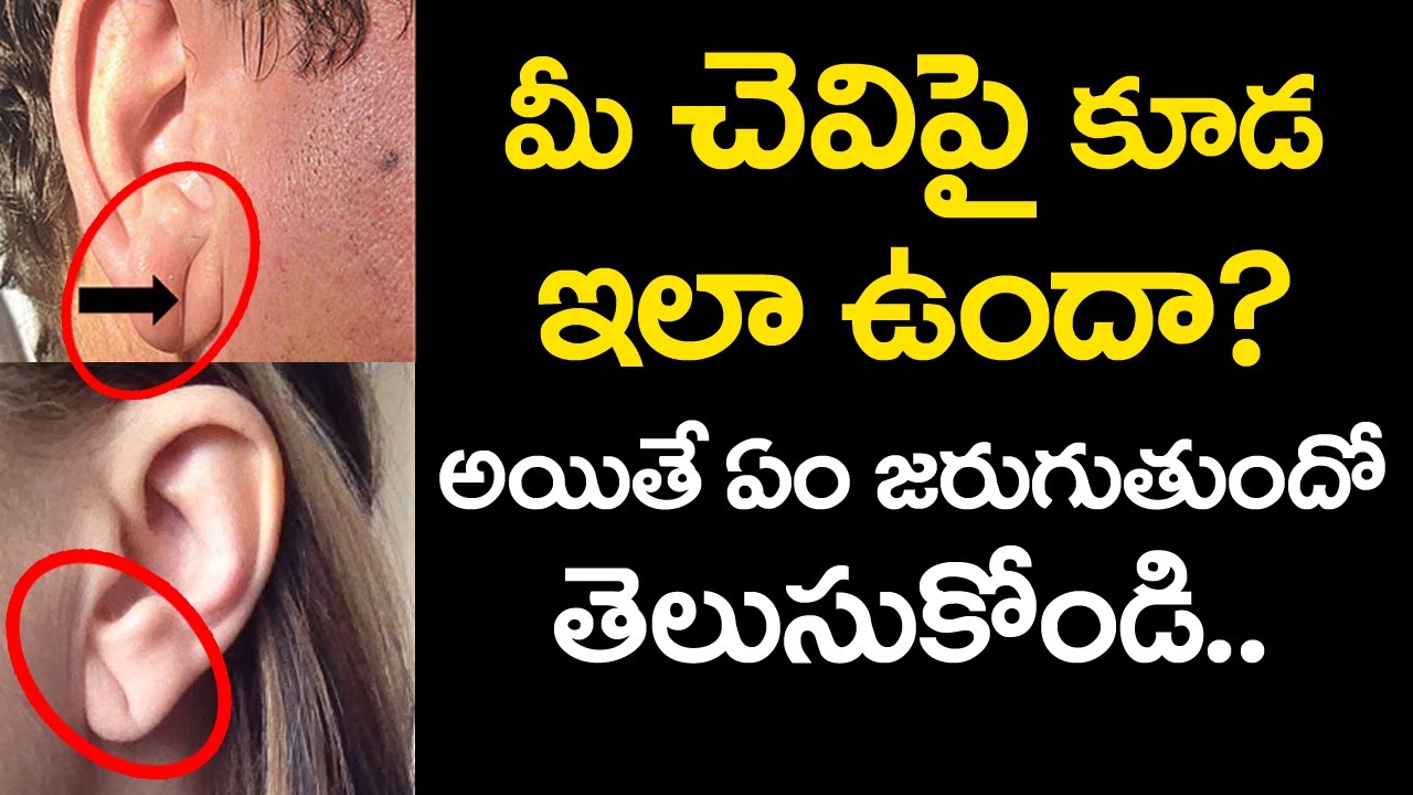 Caution! HEART DISEASE If Your Ears Are Like This | Ear With Frank ...