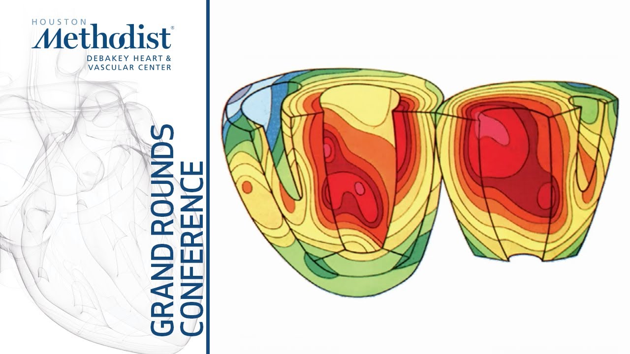 Conduction System Pacing: State of Current Practice (Kenneth A ...