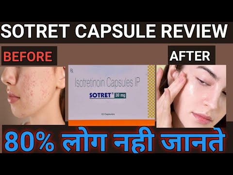 Sotret 30 mg capsule use in hindi, sotret capsule review,acne problem ...