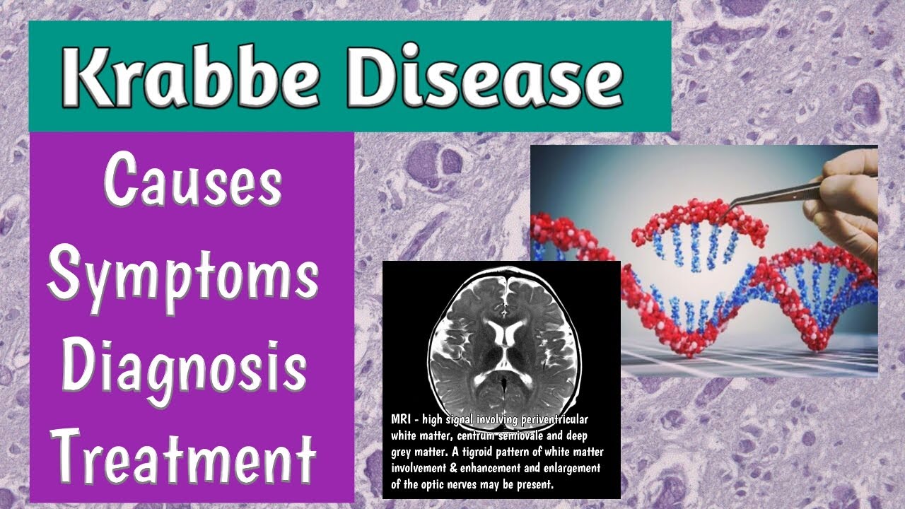 Krabbe Disease Causes, Symptoms, Diagnosis & Treatment | Globoid Cell ...