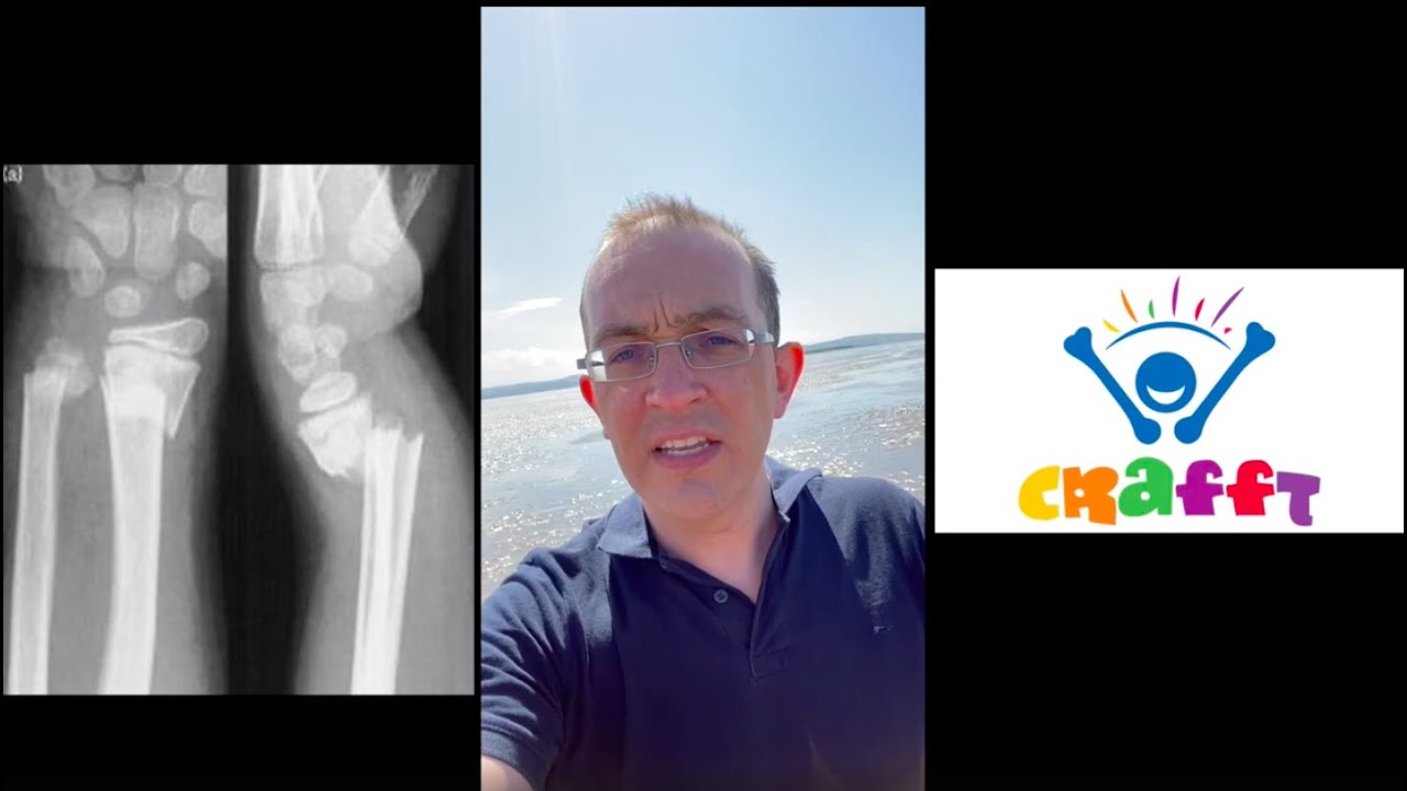 case takeaway - Dan Perry - why involve patients in study design for ...