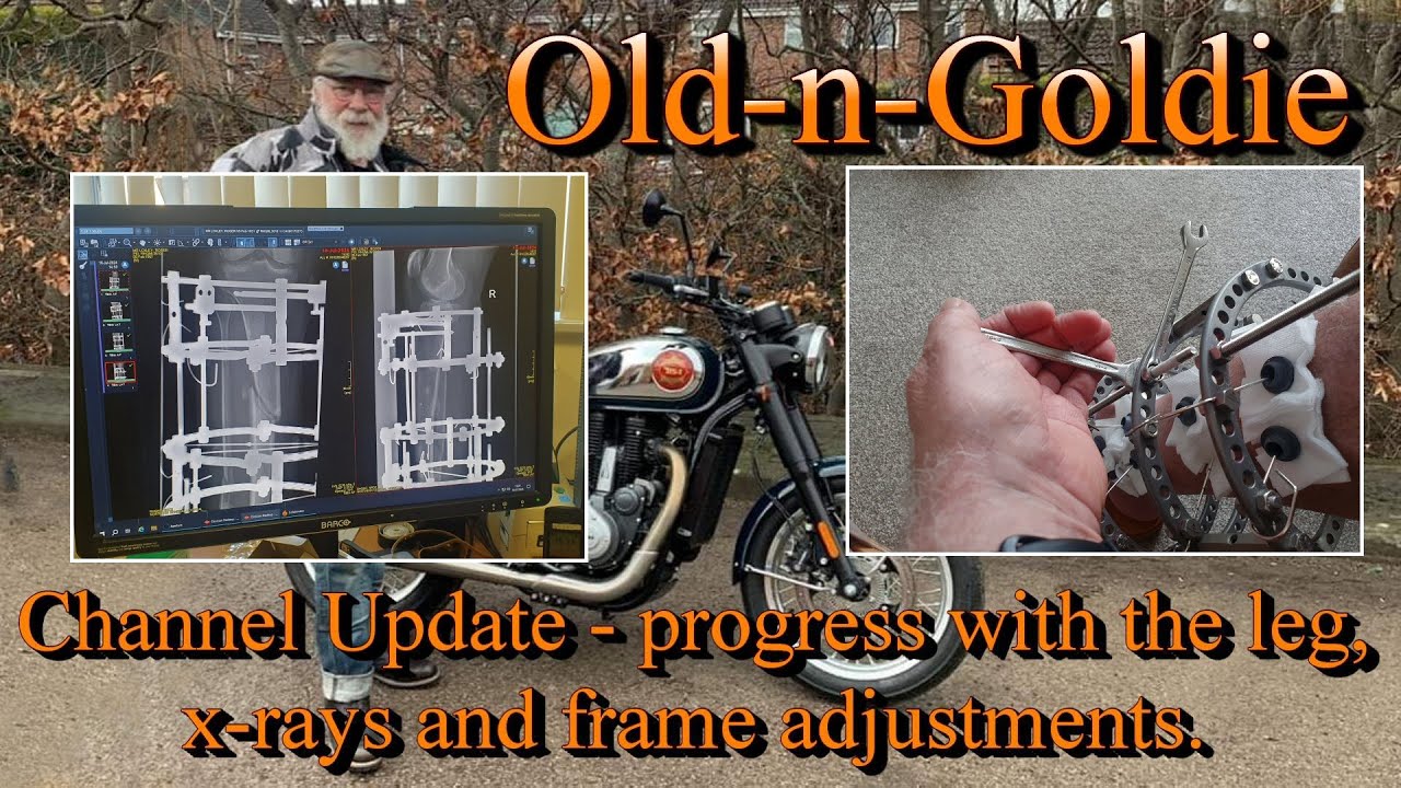 Old n Goldie - channel update, x-rays and frame adjustments. - YouTube