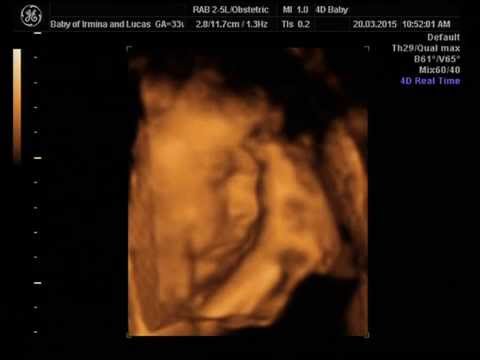 4d baby ultrasound scan at 33 weeks pregnant - YouTube