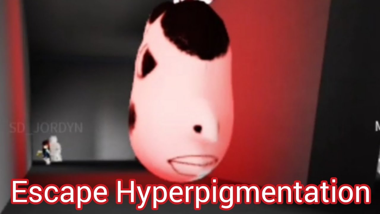 Escape Hyperpigmentation - Full Walkthrough | Roblox - YouTube