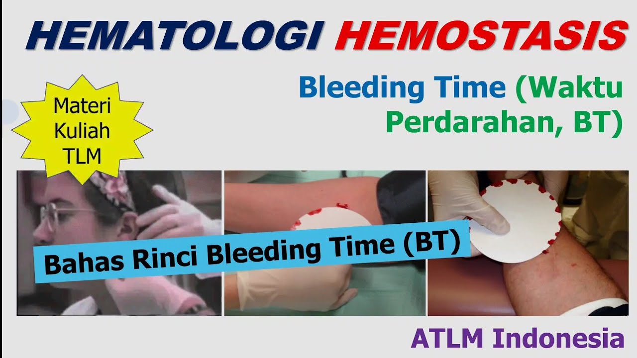 Bleeding Time Metode Ivy & Duke Masa Perdarahan Fungsi Trombosit & Kapiler Pembuluh Analis ...