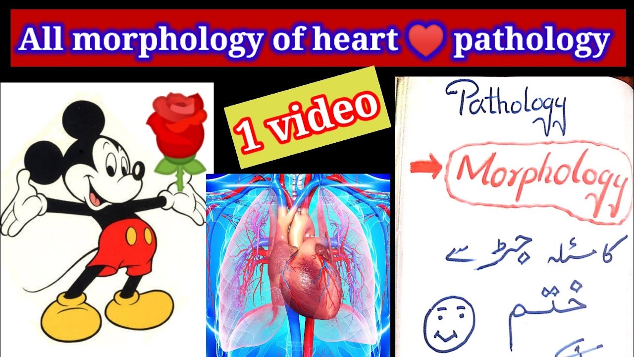 Heart ♥ pathology Morphology in 1 video. #patho #heart #endocarditis # ...