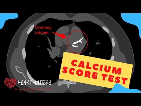 All About the Calcium Score | Heart Scan