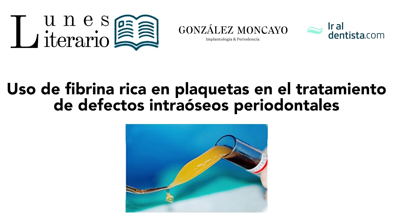 Uso de fibrina rica en plaquetas en el tratamiento de defectos ...