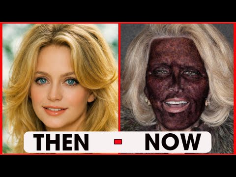 18 Celebrities Who Completely Ruined Their Faces With Plastic Surgery | Then And Now 2026