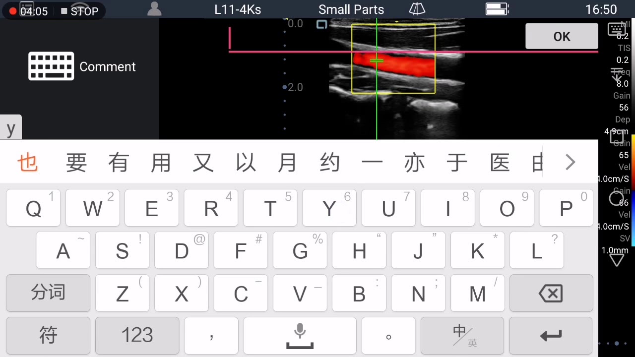 How to install and use the Android software for Youkey D8 wireless ...