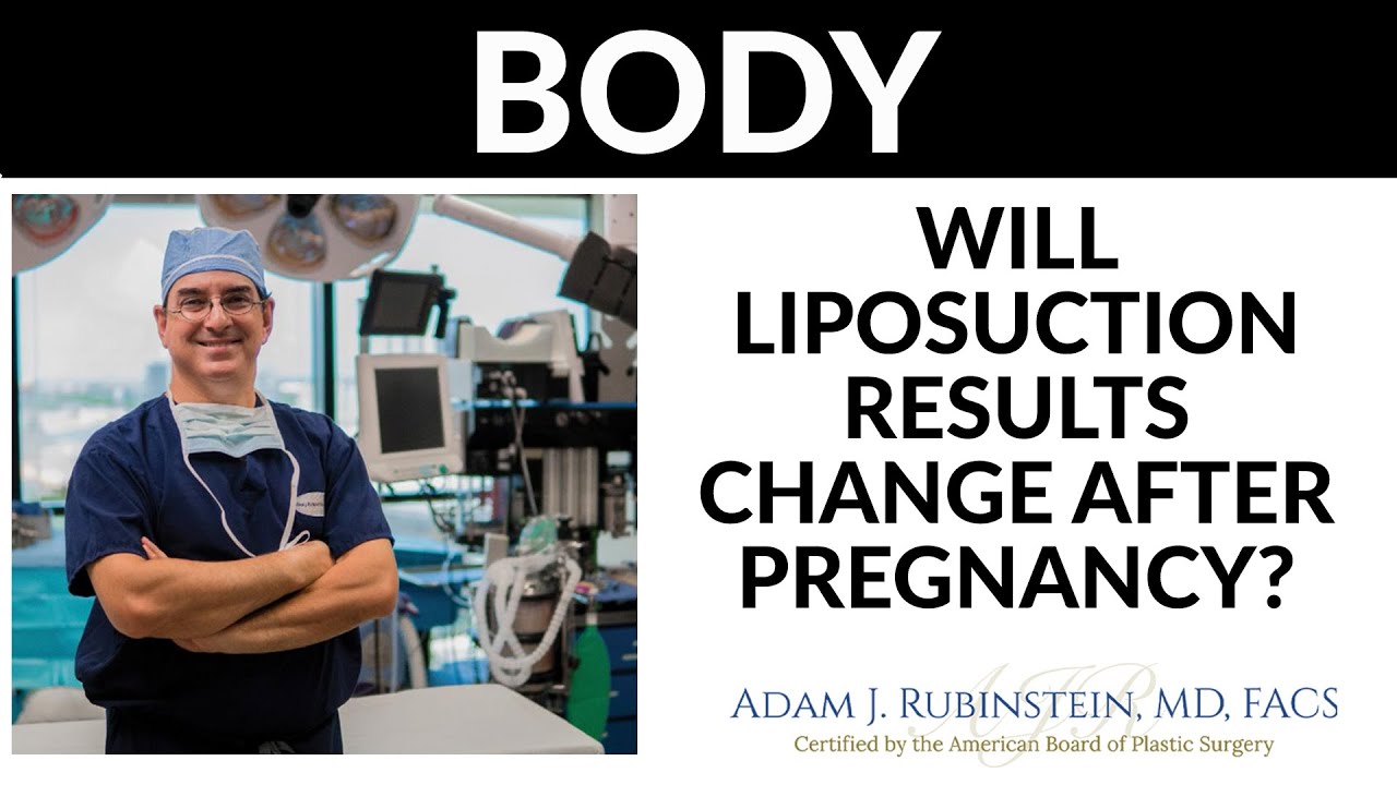 Plastic Surgery Truths - Will Liposuction results change after ...