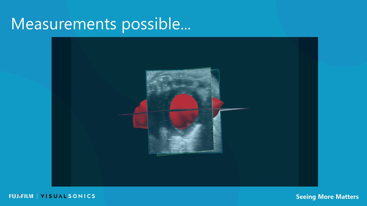 4D Mode - Available only on the Vevo 3100 - YouTube