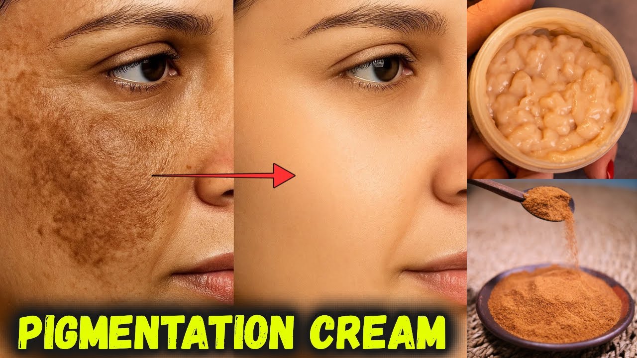 Remove Pigmentation & Dark Spots in 7 days | Homemade Skin Brightening ...