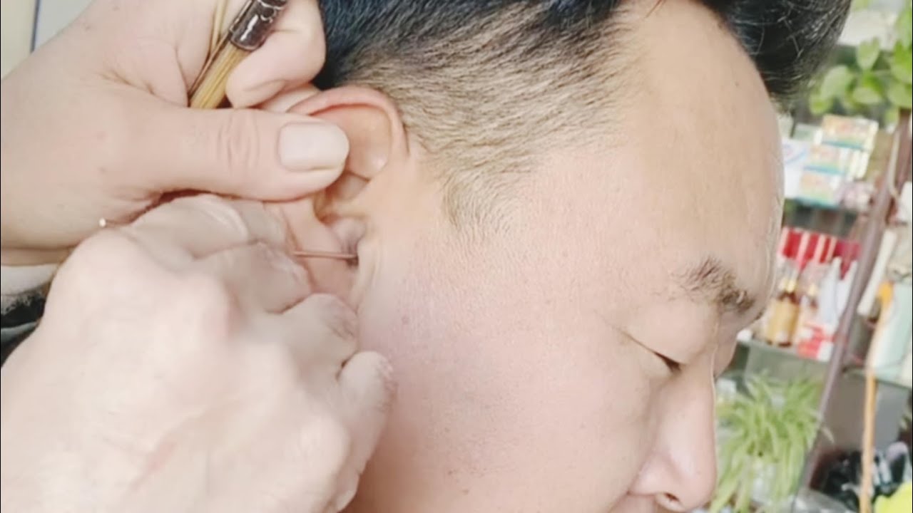 MOST SHOCKING EAR YOU HAVE NEVER SEEN - YouTube
