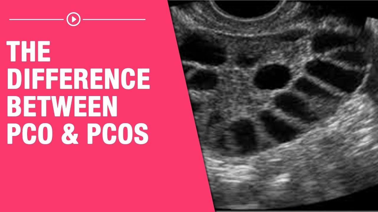 The Difference between PCO & PCOS - YouTube