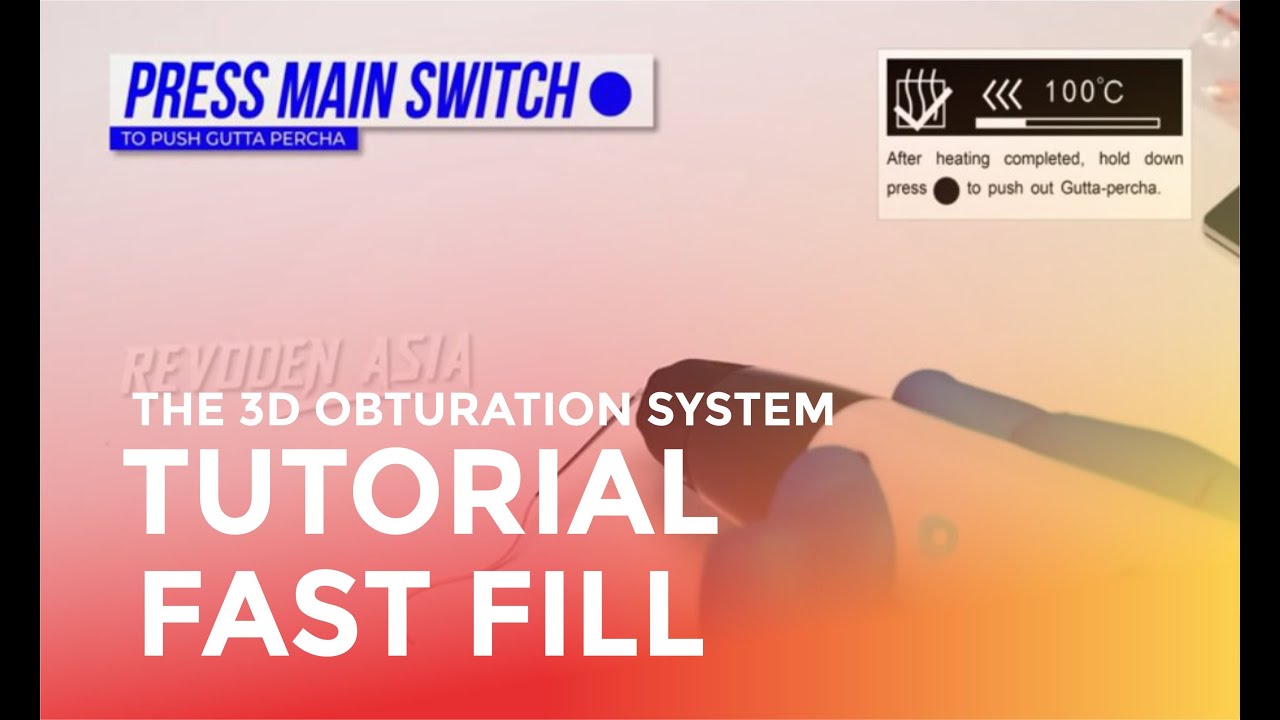 How To Use Fast fill 3D obturation System Eighteeth - YouTube