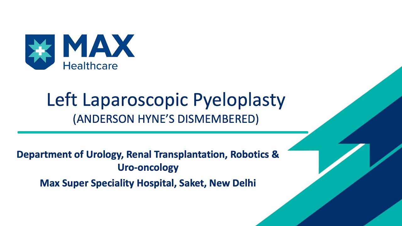 Left Laparoscopic Pyeloplasty (Anderson-Hynes) | UPJ Obstruction ...