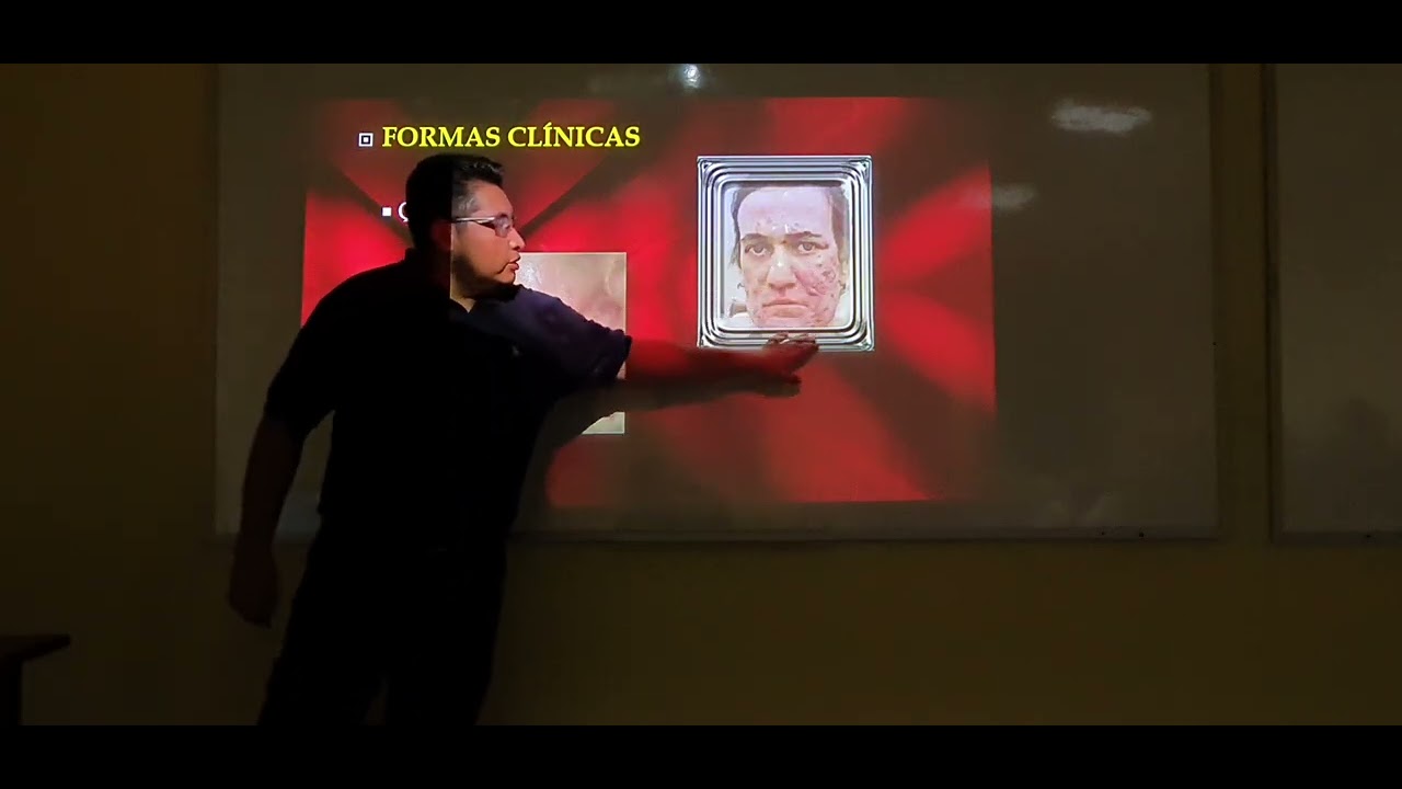 Dermato Aula 3 1 Parcial YouTube dermato-aula-3-1-parcial-youtube