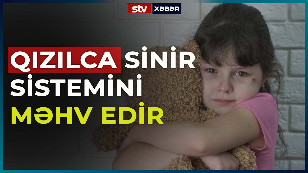QIZILCA SİNİR SİSTEMİNİ MƏHV EDİR - XÜSUSİ XƏBƏR - YouTube