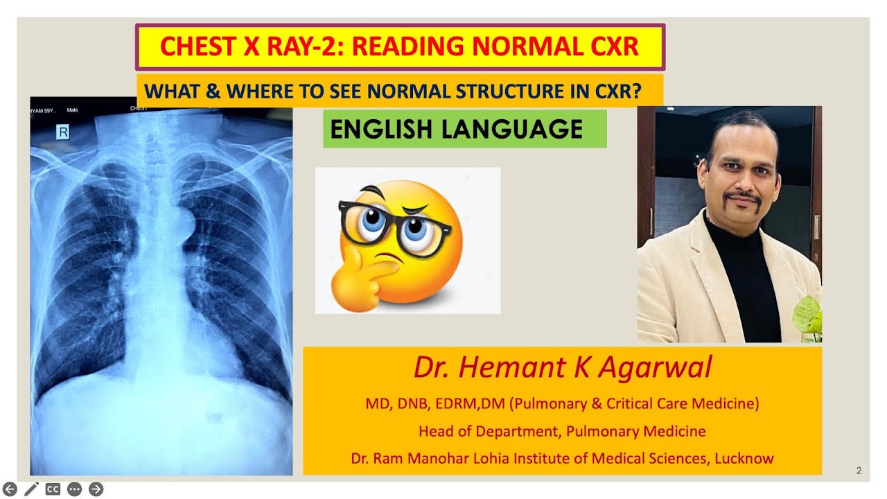 Radiology-Chest X Ray Class-2 (ENGLISH), How to Read Normal X Ray ...