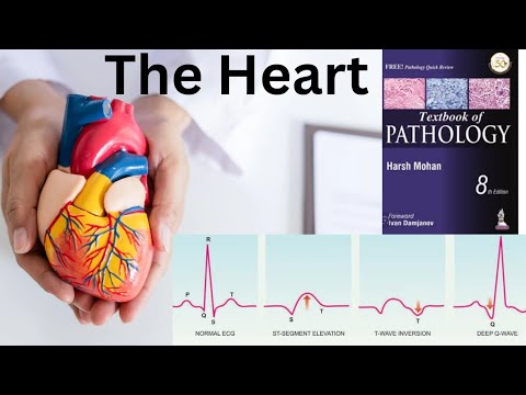 chap 16 pt .1 The Heart, special pathology,Harsh Mohan, quick review ...