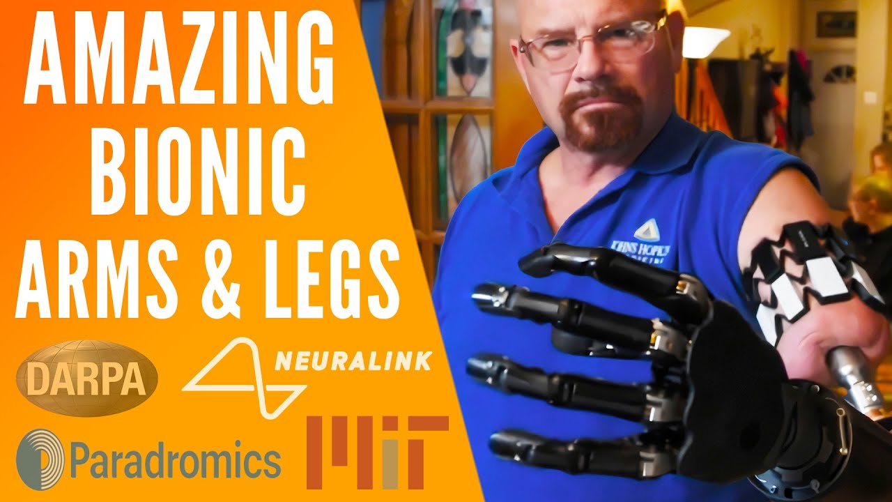 Amazing Robot Arms & Legs - Futuristic Robotic Prosthetics - YouTube