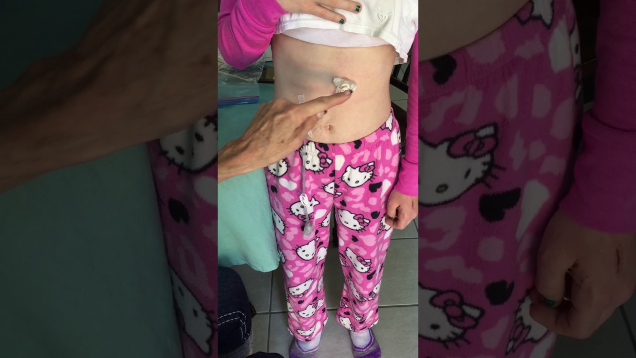 Changing connection for the feeding port ! - YouTube