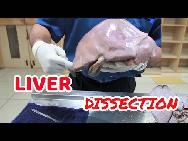Human Stomach Dissection