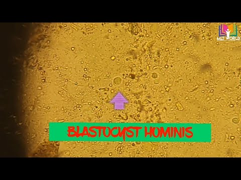 Blastocystis hominis parasite in stool microscopy. 40X view - YouTube
