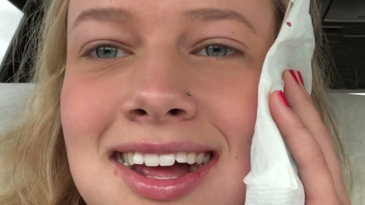 Bye Bye Wisdom Teeth - YouTube