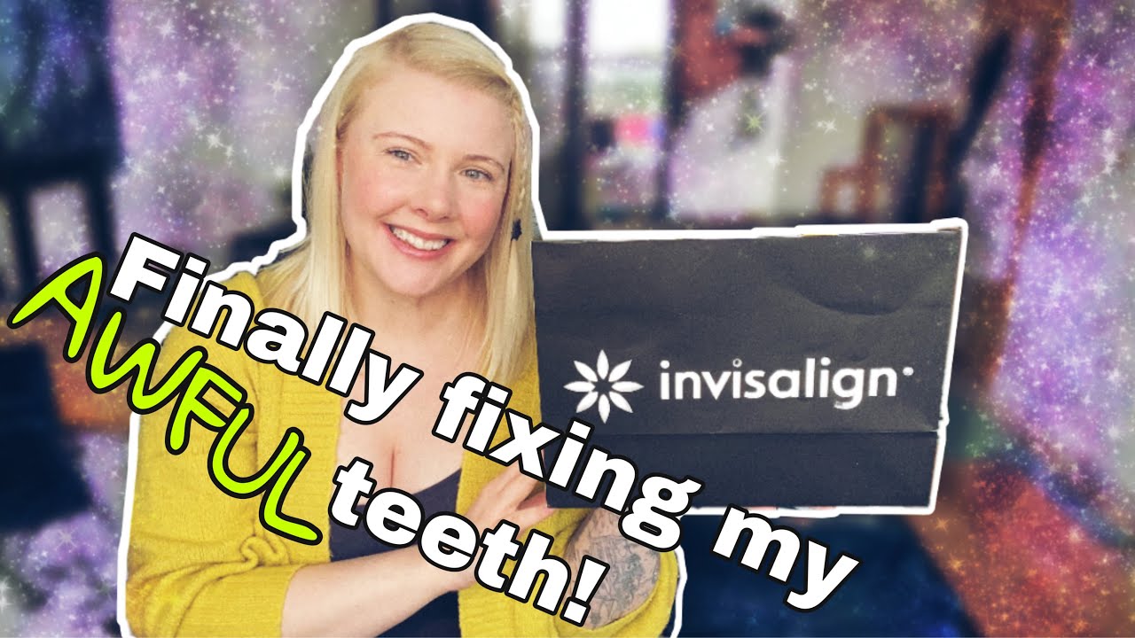 Invisalign Honest Review and Video Diary: Part 1 - YouTube