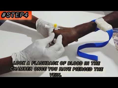 IV CANNULATION. | step by step guide | - YouTube